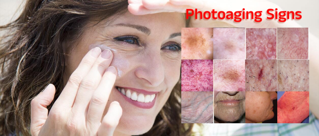 "광노화(Photoaging)는 피부노화의 90%를 차지" 그 진실은? - unageing